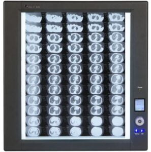 X-Ray Viewer - Regalmed | Medical Equipment in Dubai